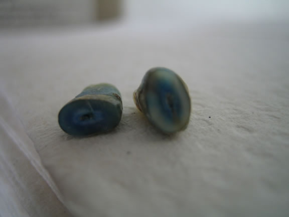 Endodontics – Photolase